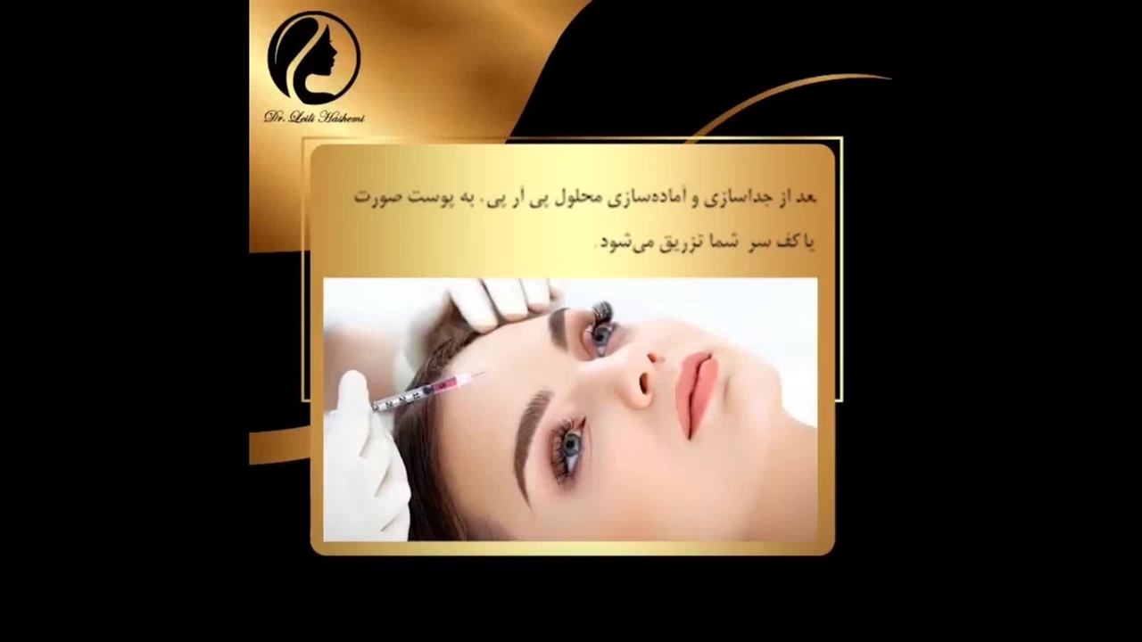 پی آر پی چیست؟معجزه جوانسازی پوست - نماشا